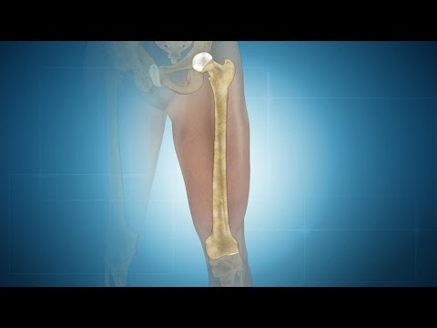 What is Femur?