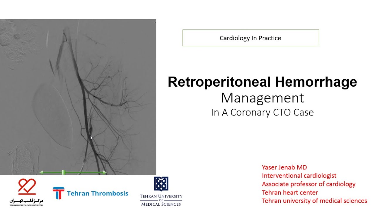 Retroperitoneal hemorrhage management after coronary CTO procedure