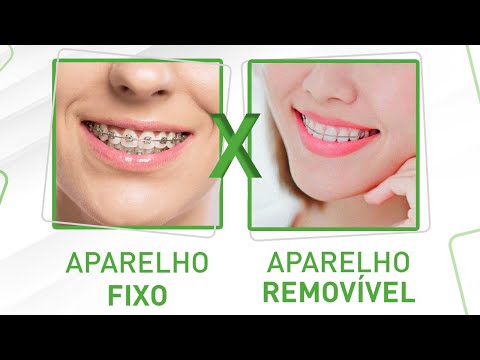 🦷 APARELHO FIXO x APARELHO REMOVÍVEL [Medicina Dentária]