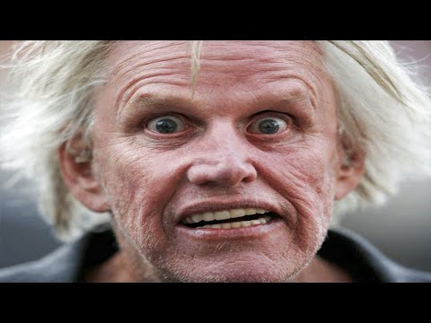 NEW! Gary Busey Is 78, Look at Him Now After He Lost All His Money