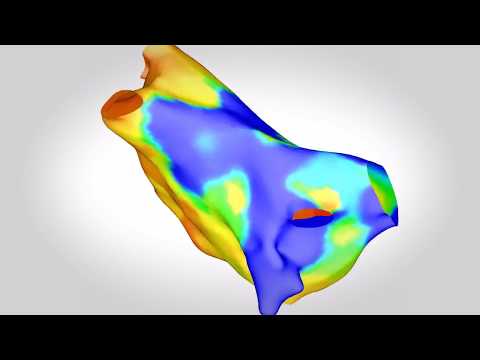 Cardiac Interventions: Guy's and St Thomas' NHS Foundation Trust & King’s College London