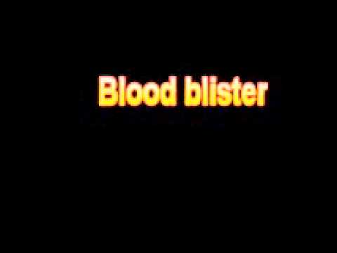 What Is The Definition Of Blood blister Medical Dictionary Free Online