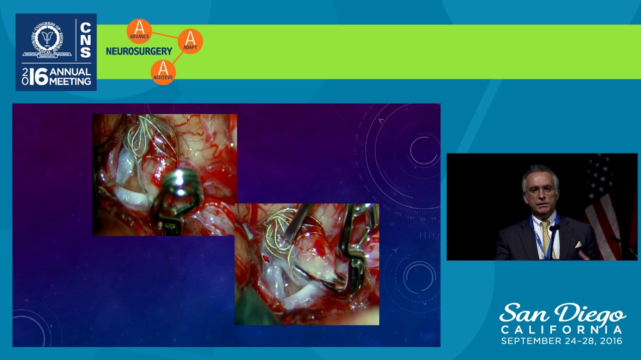 CNS 2016 Advances in Disruptive Innovation in Neurovascular Surgery