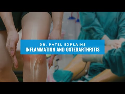 Dr. Patel Explains Inflammation and Osteoarthritis