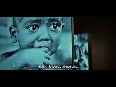Smallpox eradication : Science, solutions, solidarity