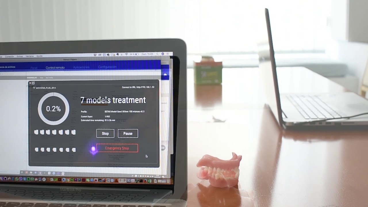 Microlay Versus 385 4K® Dental & Industrial 3D Printer – Microlay ...