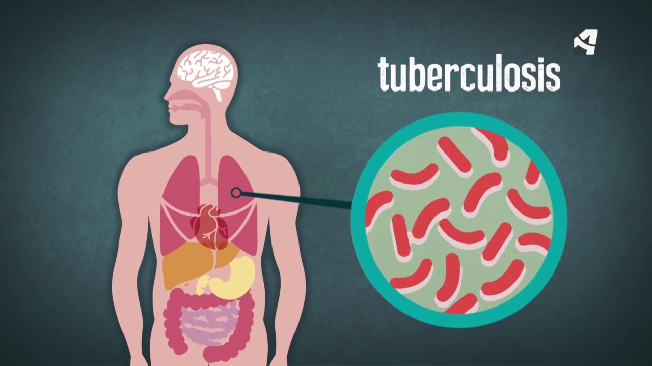 ¿Qué es una bacteria?