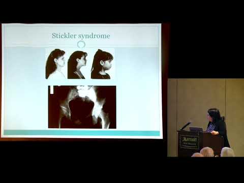 2015 CSF Colloquium Epidemiology of Hereditary Hypermobility Connective Tissue Disorders