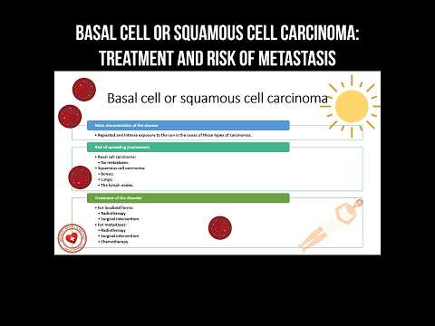 Basal cell or squamous cell carcinoma: treatment and risk of metastasis #carcinoma #oncology #cancer