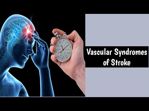 Vascular Syndromes Of Stroke||Stroke Syndromes||Types Of Stroke Syndromes||Vascular Stroke