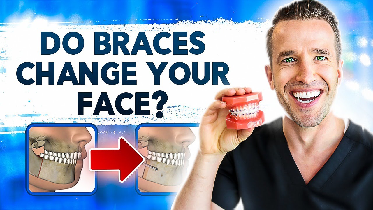 How Braces Change Your Face | Dr. Nate Orthodontist