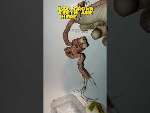 Growing teeth in our lab. part2
