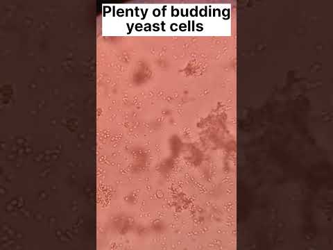 BUDDING YEAST CELLS IN URINE SEDIMENT #mlt #youtubeshorts #shortsvideo