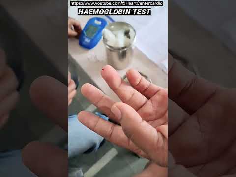 how to check hemoglobin || Hemoglobin test || cardiologist doctor|| #viral #viralvideo #like #video