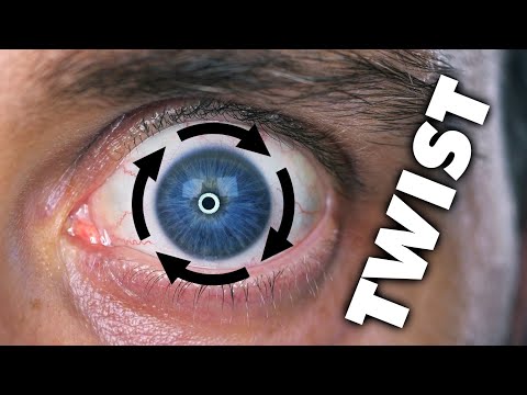 Why your eyes can rotate: an evolutionary explanation – Why Evolution ...