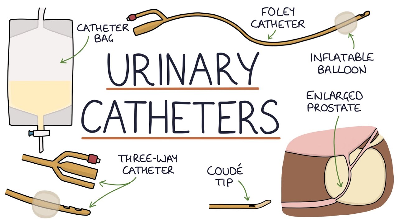 Urinary Catheters