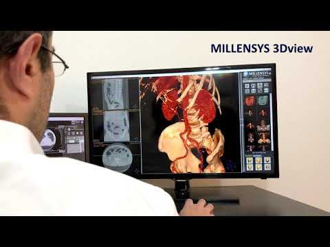 Vision Tools 3Dview