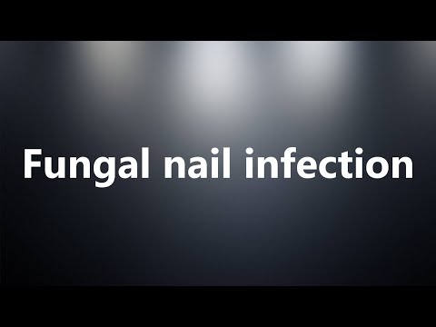 Fungal nail infection - Medical Meaning and Pronunciation