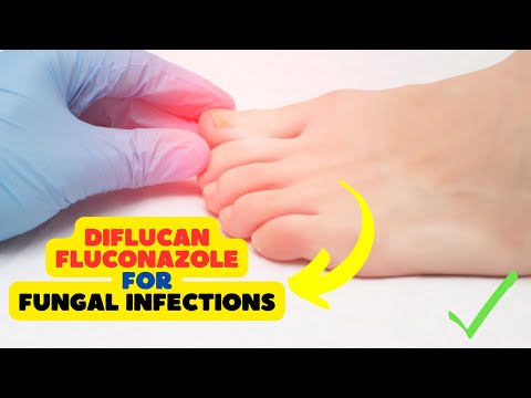 Diflucan Fluconazole: Optimizing Treatment for Fungal Infections