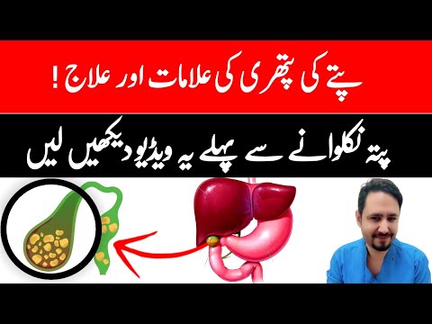 Gallbladder Stones - Bile Salt In Urdu Hindi - Dr Irfan