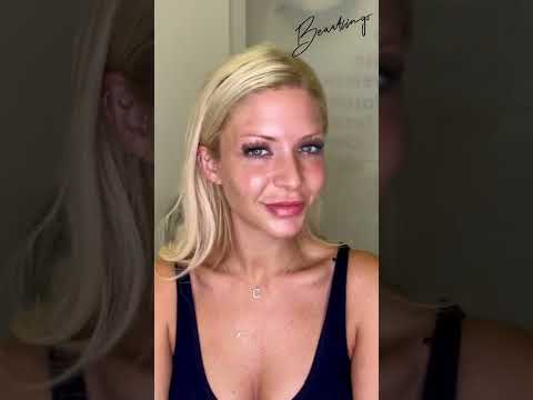 Texas Slim face Dr. Kinan, Beautiingo Clinics, Dubai Marina Branch