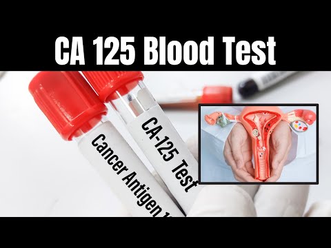 CA 125 Blood Test Explained: Uses, Procedures, and What It Means for You