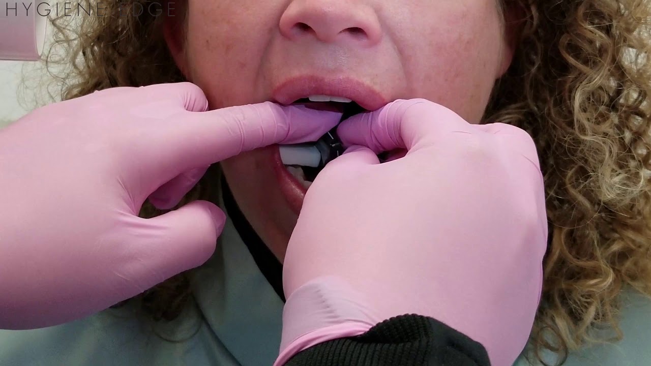 Digital Dental Bitewing Tips