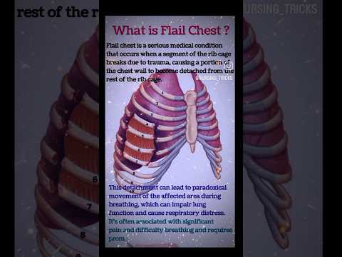 what is flail chest ? | Ribs fracture | #medical #health