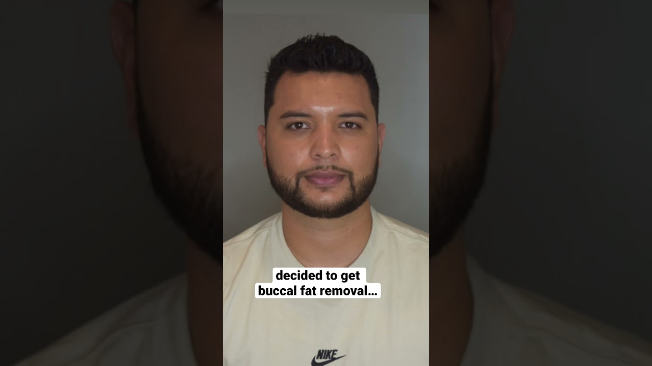 How to slim your face  #beforeandafter