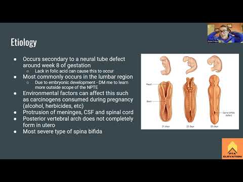Spina Bifida Myelomeningocele - NPTE Prep