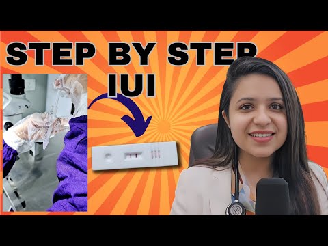 IUI process step by step | IUI treatment for pregnancy