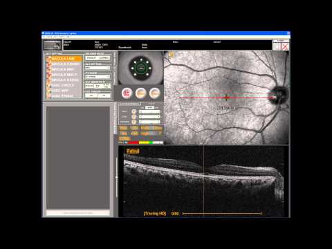 RS3000 Advance Scans.Regular, Fine, Ultra-Fine.wmv