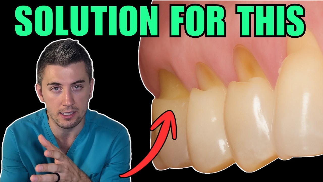 Notches in Your Teeth? (How to Fix Them)