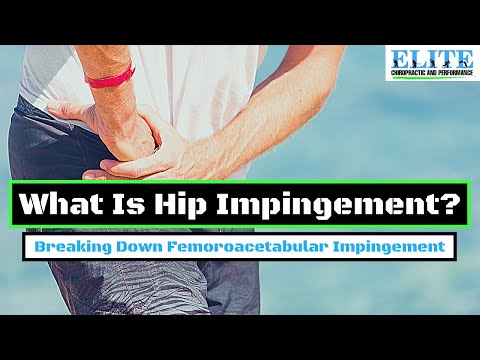 What Is Hip Impingement | Femoroacetabular Impingement | Chesterfield Chiropractor