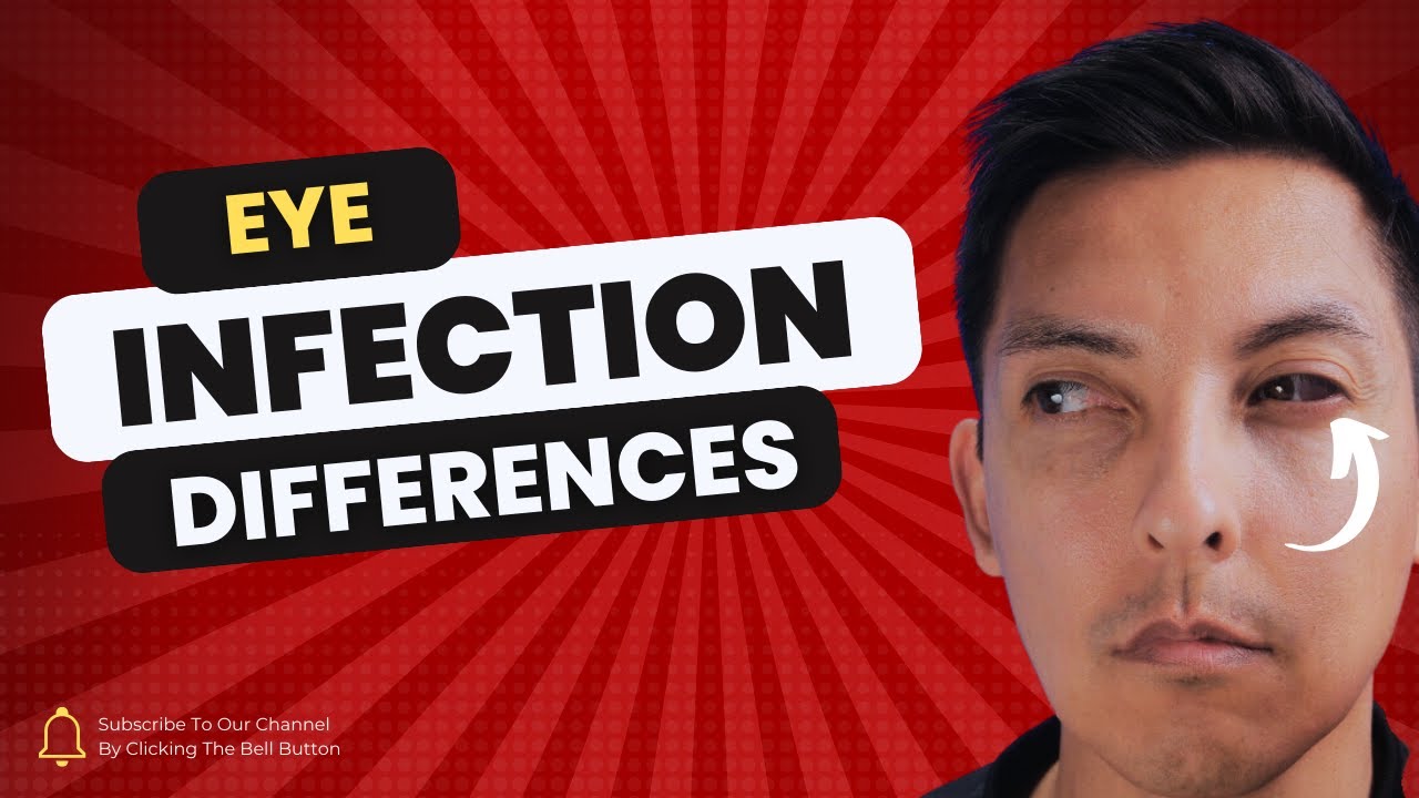 DON'T PANIC: How to Distinguish Conjunctivitis, Pink Eye, and Eye Infections in 2024