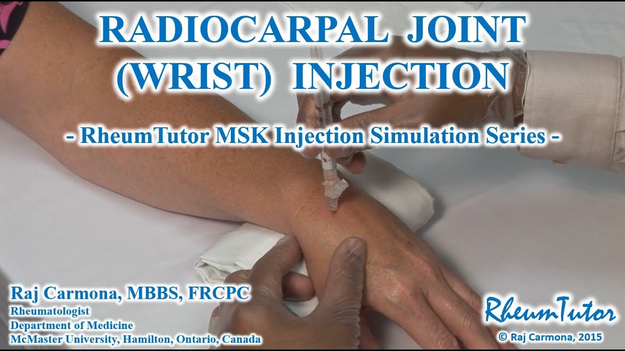 WRIST (RADIOCARPAL JOINT) INJECTION: Step-By-Step Instructions