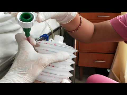 Common Mistake in Surgical Drain Handling
