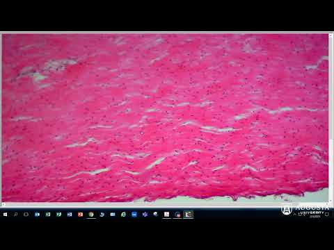Anatomy & Physiology 1: Dense Connective Tissue - Dense Regular Connective Tissue