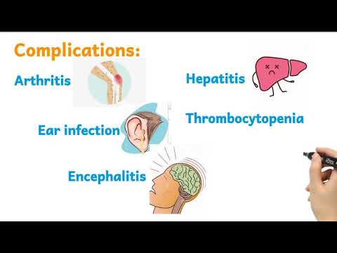 Rubella ( Causes, Symptoms, Diagnosis & Management)