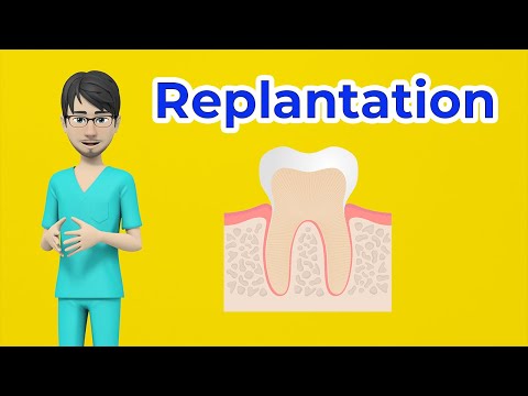 Intentional replantation of tooth