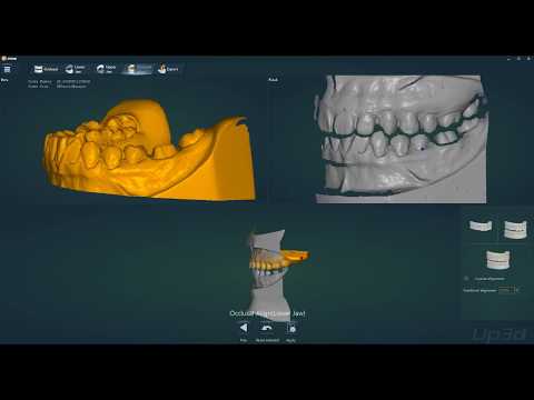 how to scan big articulator with UP300+