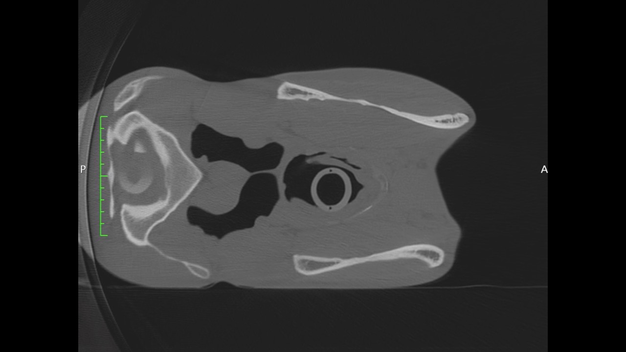 BodyTom® - Equine C Spine Slices and 3D