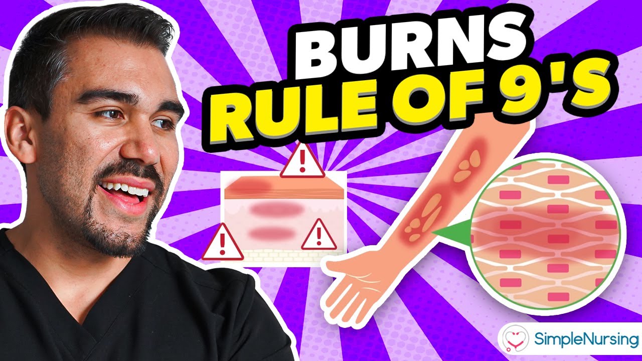 Understanding Burns: Types, Causes, and Care Techniques | Galaxy.ai