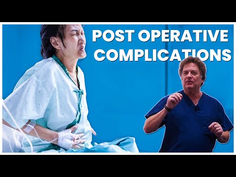 Post-Operative Complications: Chest Pain | Kaplan Surgery