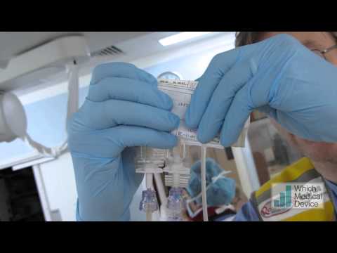 Islet cell transplantation for Diabetes