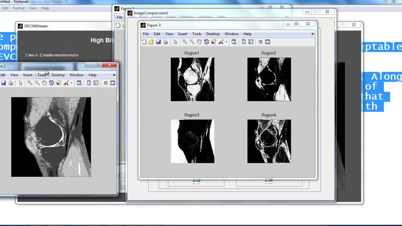 image processing project topics in matlab | image processing thesis topics in matlab