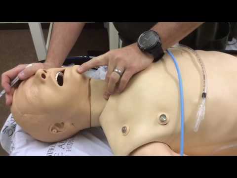 Surgical Cricothyroidotomy - DAS 2015 Technique