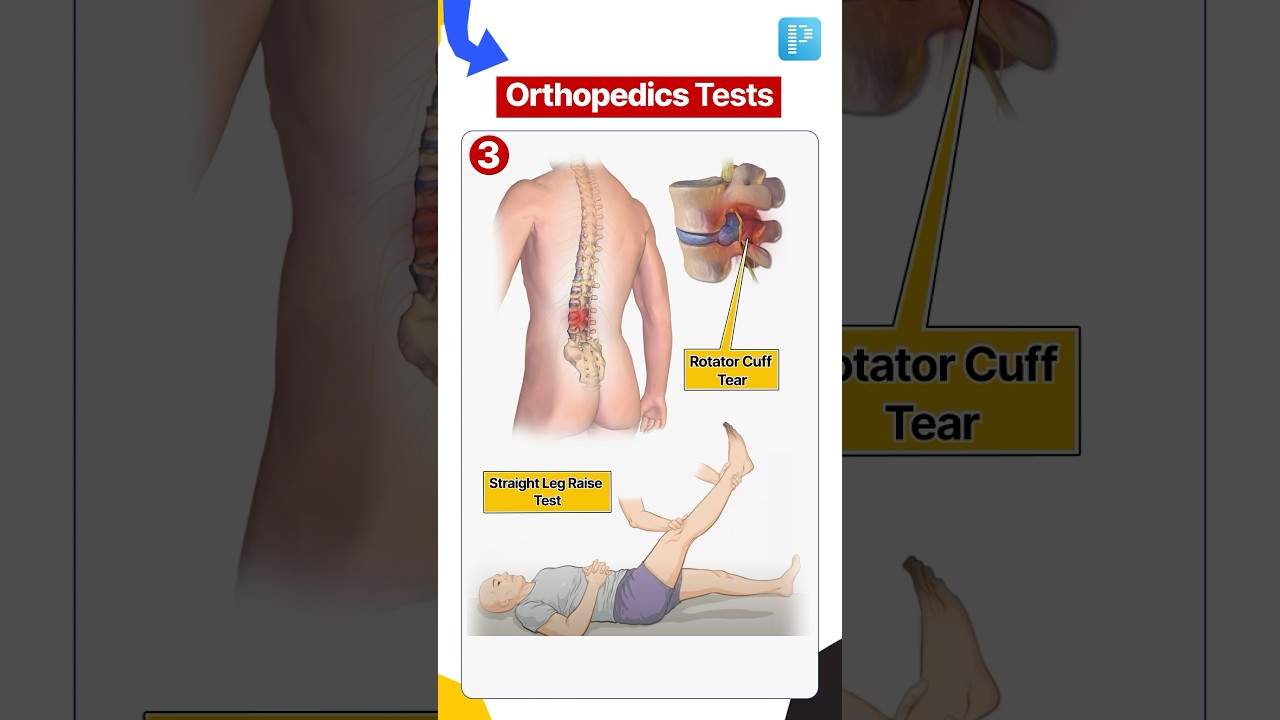 Must Know Orthopedics Test!
