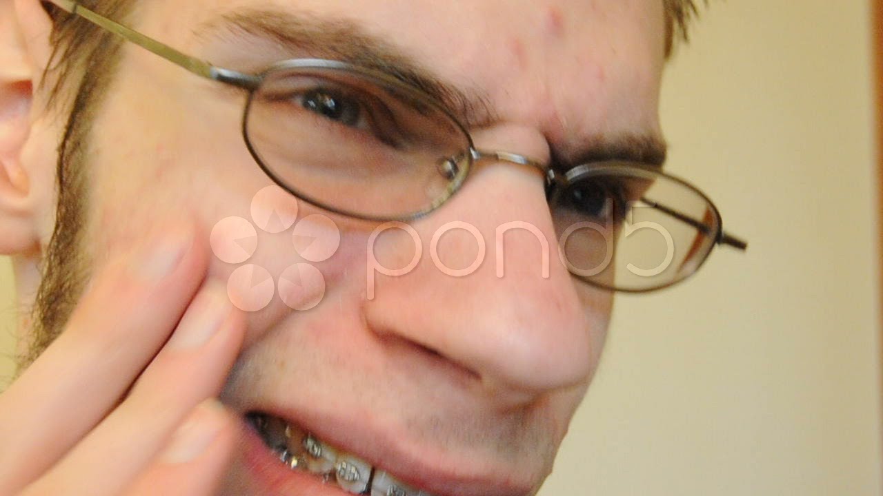 Teenager Scratching Acne Face. Stock Footage