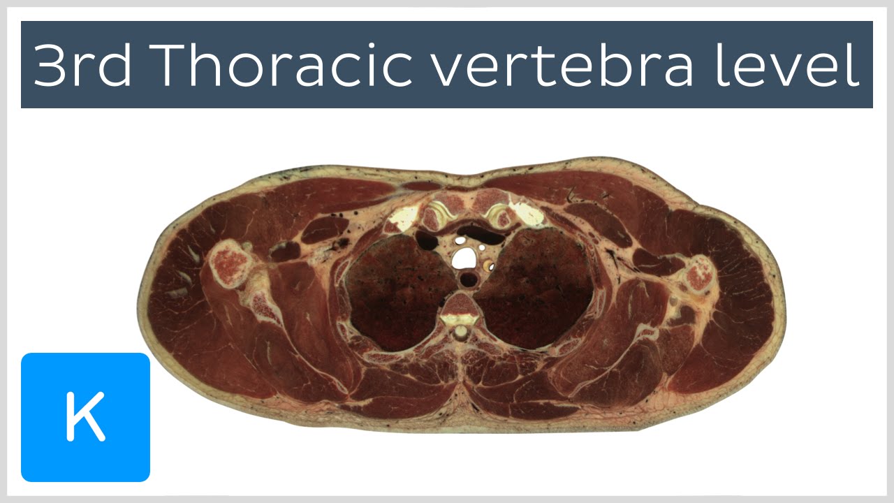 Cross Sections: 3rd Thoracic Vertebra Level - Human Anatomy | Kenhub